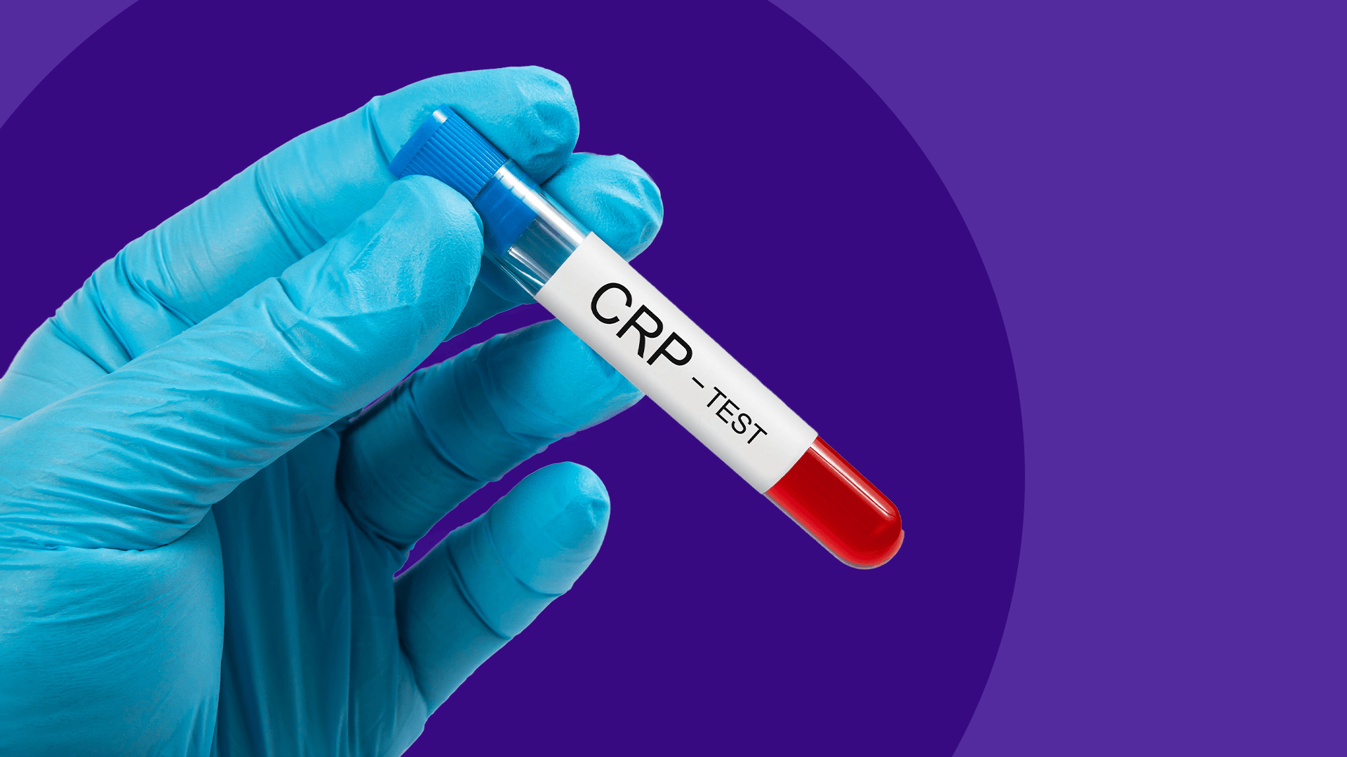 Know How To Interpret C Reactive Protein CRP Test Results News Ch